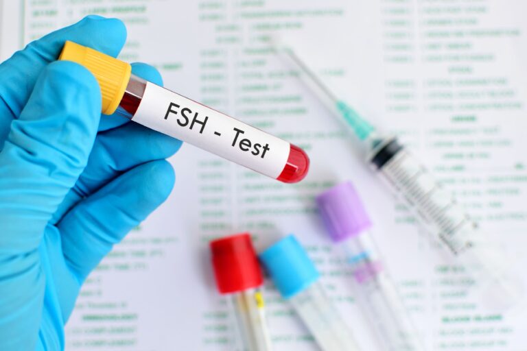 Does low FSH affect Female Fertility? Treatments for low FSH levels